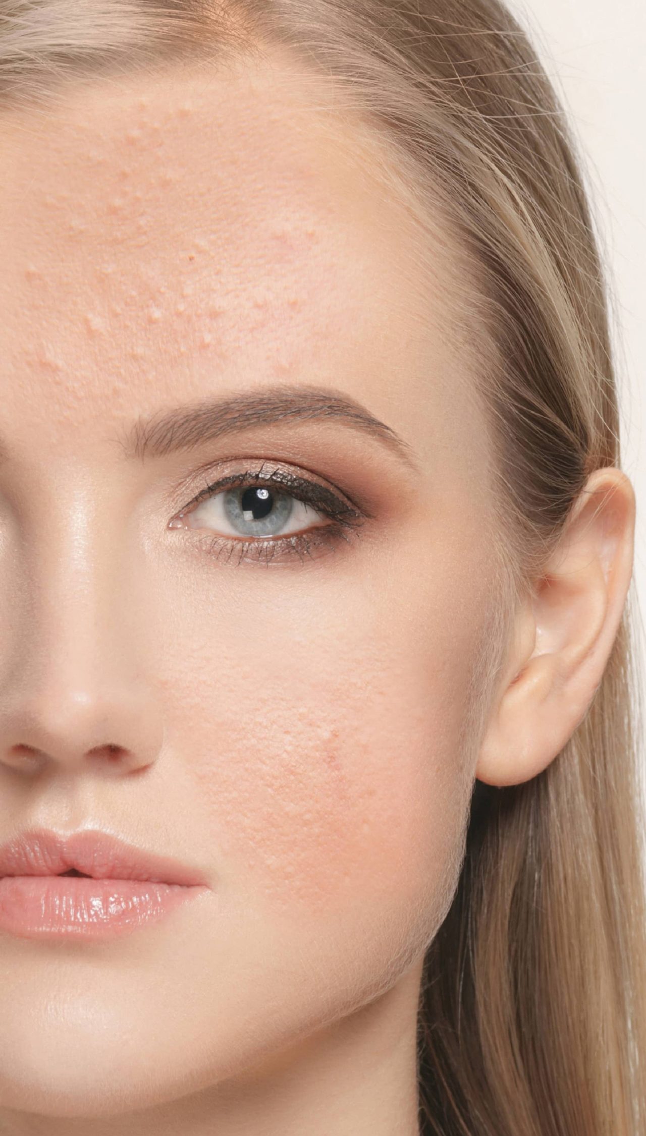 Dermal Infusion - Pure Benefits